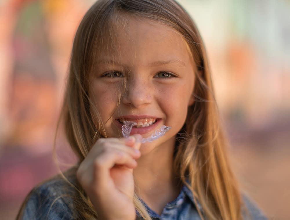 Should I Get Invisalign for My Kids? 8 Things Every Parent Should Know ...